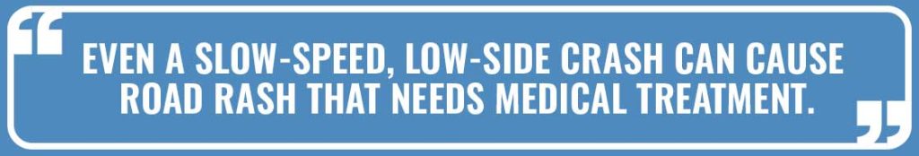 Road Rash From Motorcycle Accident in Kentucky