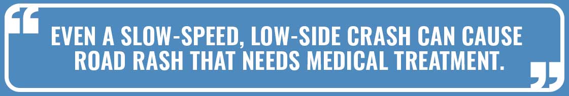 Road Rash From Motorcycle Accident in Kentucky