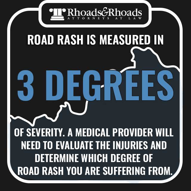 Road Rash From Motorcycle Accident in Kentucky